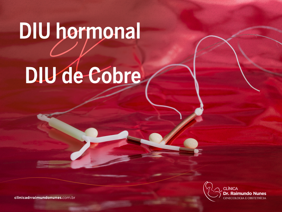 O que fazer após colocar o DIU? | Clínica Dr. Raimundo Nunes